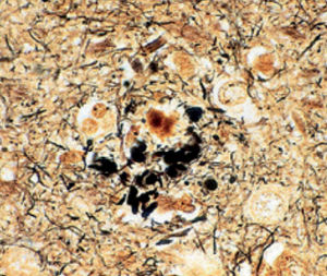 Réactif solution de coloration - Fouchet Van Gieson - BIO-OPTICA Milano ...