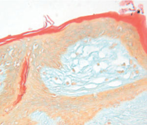 Réactif solution de coloration - Grocott - BIO-OPTICA Milano - pour ...