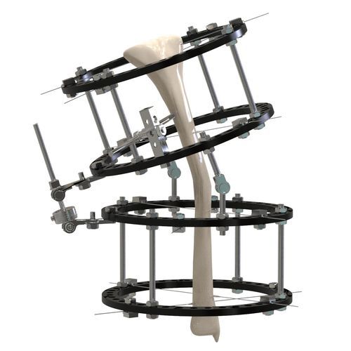 Fixateur externe de tibia - 11611 series - Canwell Medical - hybride