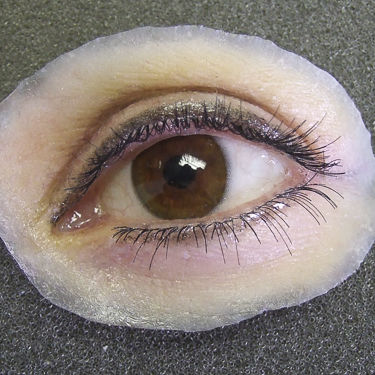 Épithèse orbitale - Medical Art Prosthetics - adulte