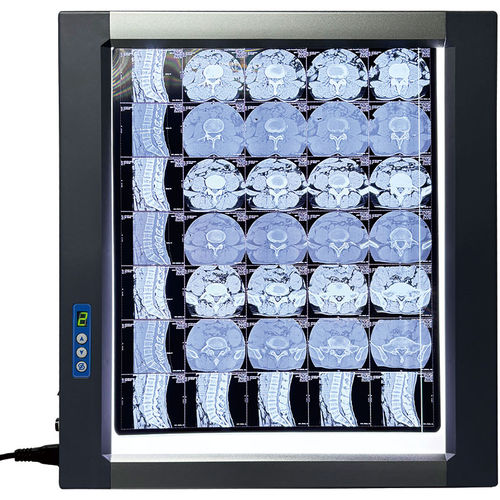 Négatoscope LED - MST-4000I - Shantou Easywell Electronic Technologies ...