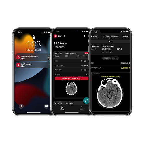 Application mobile pour diagnostic de l'AVC - NCCT - RapidAI - d ...