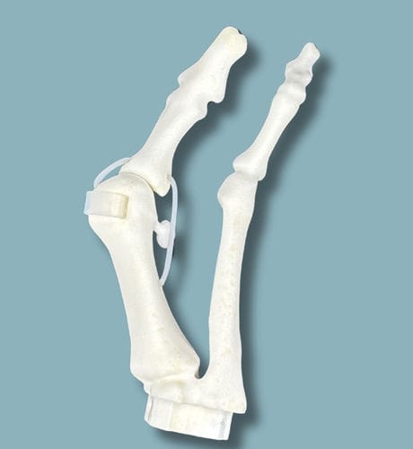 Modèle anatomique de métatarse - 01-09-01 - ADDIDREAM - pour chirurgie ...