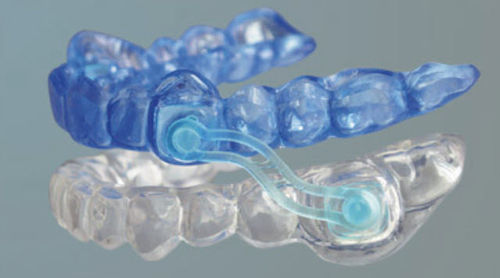 Dispositif anti-ronflement gouttière - Silensor-sl - ERKODENT Erich Kopp