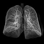 Film radiographique - Tous les fabricants de matériel médical