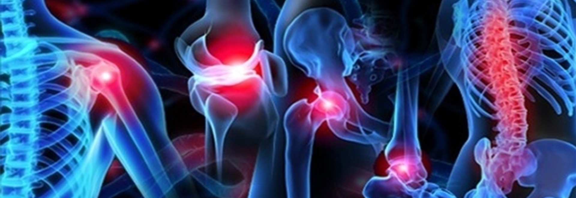 Échographie musculo-squelettique (MSK) - California, USA - SIFSOF