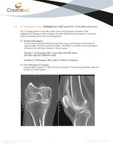 CT Protocol Guide - ConforMIS - Catalogue PDF | Documentation technique ...