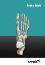 Ancre de suture de tendon bicipital - FiberTak® - Arthrex - non résorbable